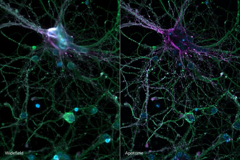 ZEISS Apotome 3: Optical sectioning in widefield fluorescence microscopy
