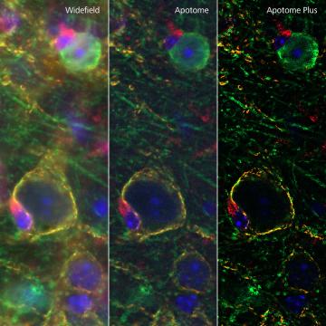 ZEISS Apotome 3: Optical sectioning in widefield fluorescence microscopy