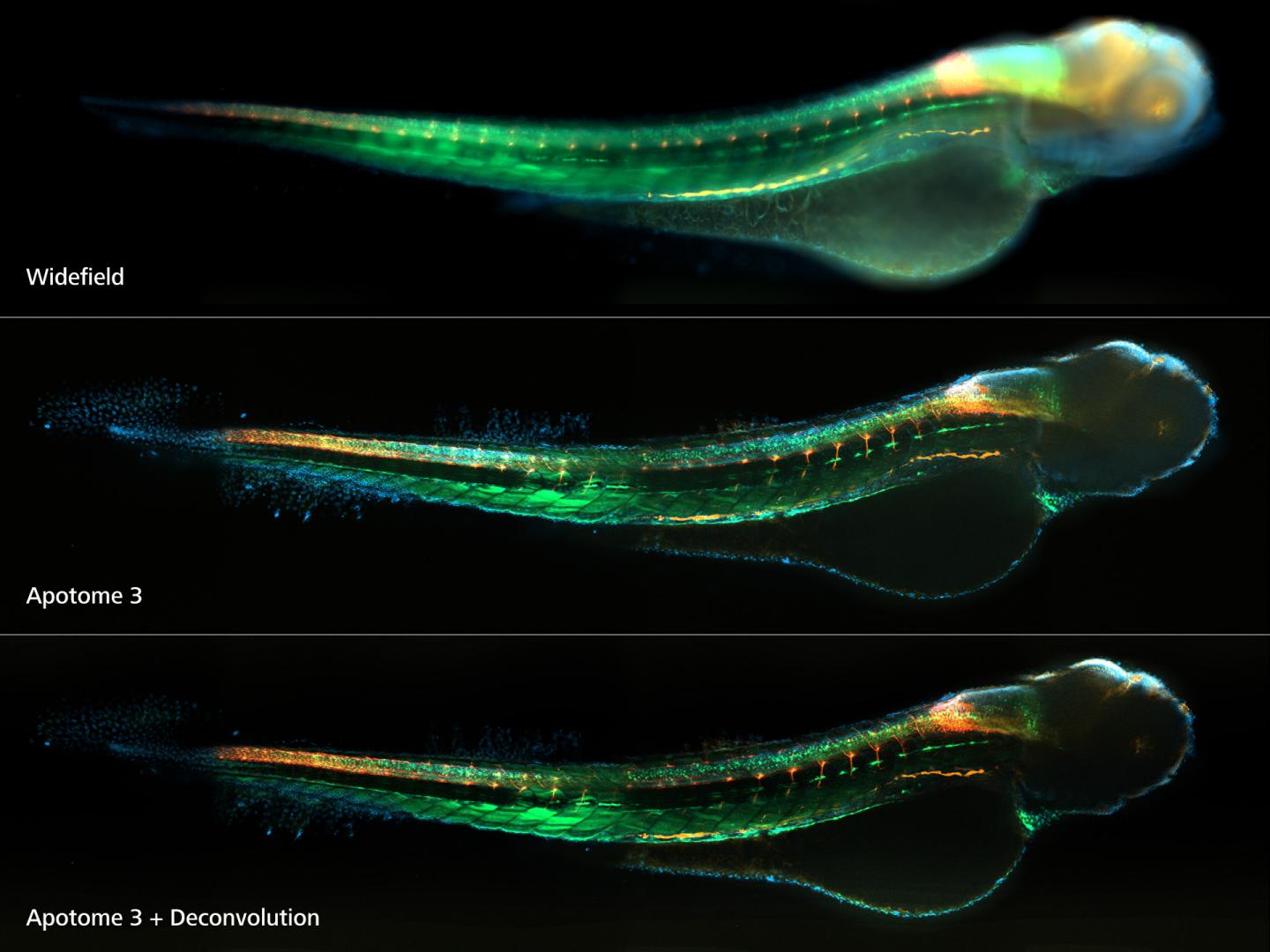 ZEISS Apotome 3: Optical sectioning in fluorescence imaging for ...