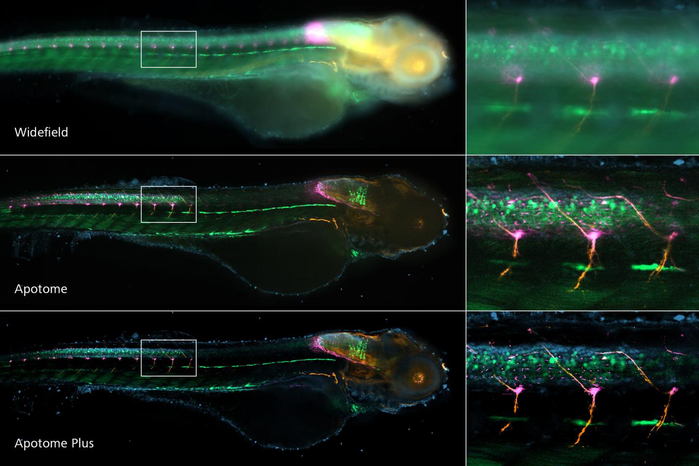 ZEISS Apotome 3: Optical sectioning in widefield fluorescence microscopy