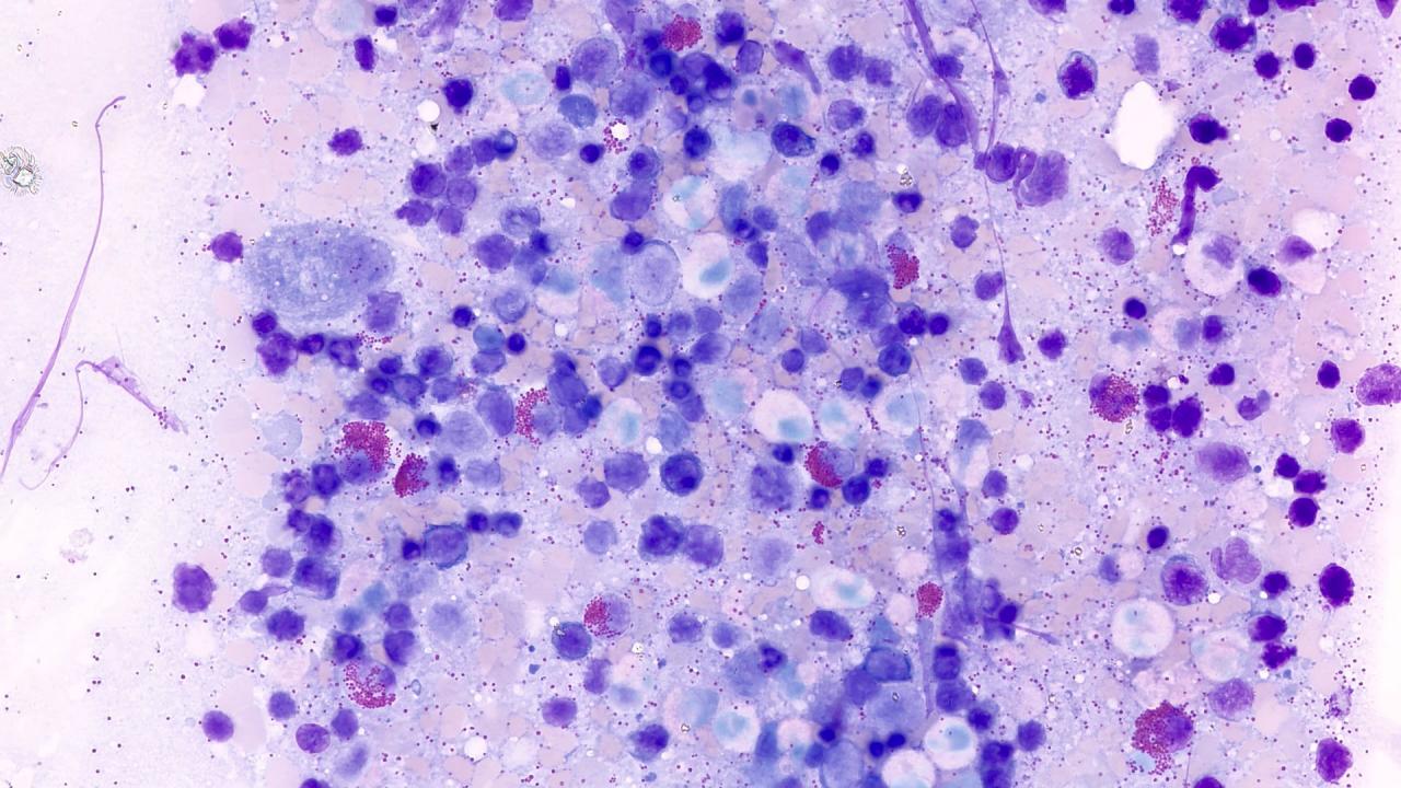 ZEISS Axiolab 5 smart microscope for easy digital documentation