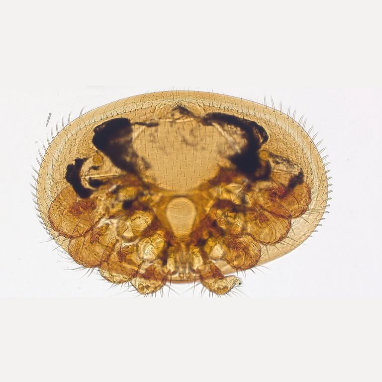 ZEISS Axiolab 5 smart microscope for easy digital documentation