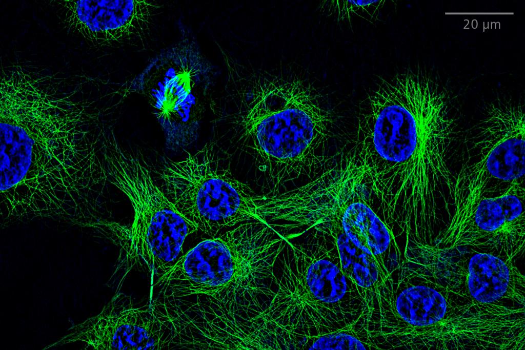 ZEISS Elyra 7: Super-Resolution and Single Molecule Localization Microscope