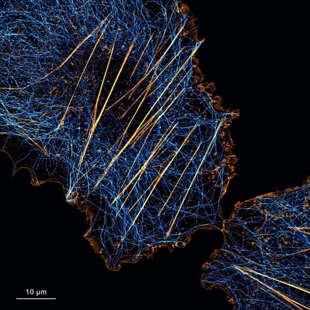 ZEISS Lattice SIM 5: Super-resolution imaging down to 60 nm