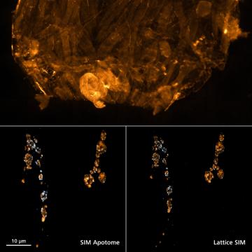 ZEISS Lattice SIM 3: Fast optical sectioning and super-resolution imaging