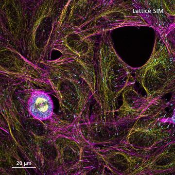 ZEISS Lattice SIM 3: Fast optical sectioning and super-resolution imaging