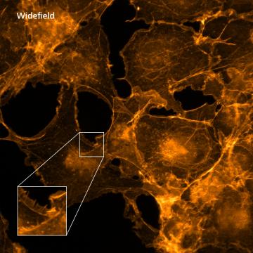 ZEISS Lattice SIM 3: Fast optical sectioning and super-resolution imaging