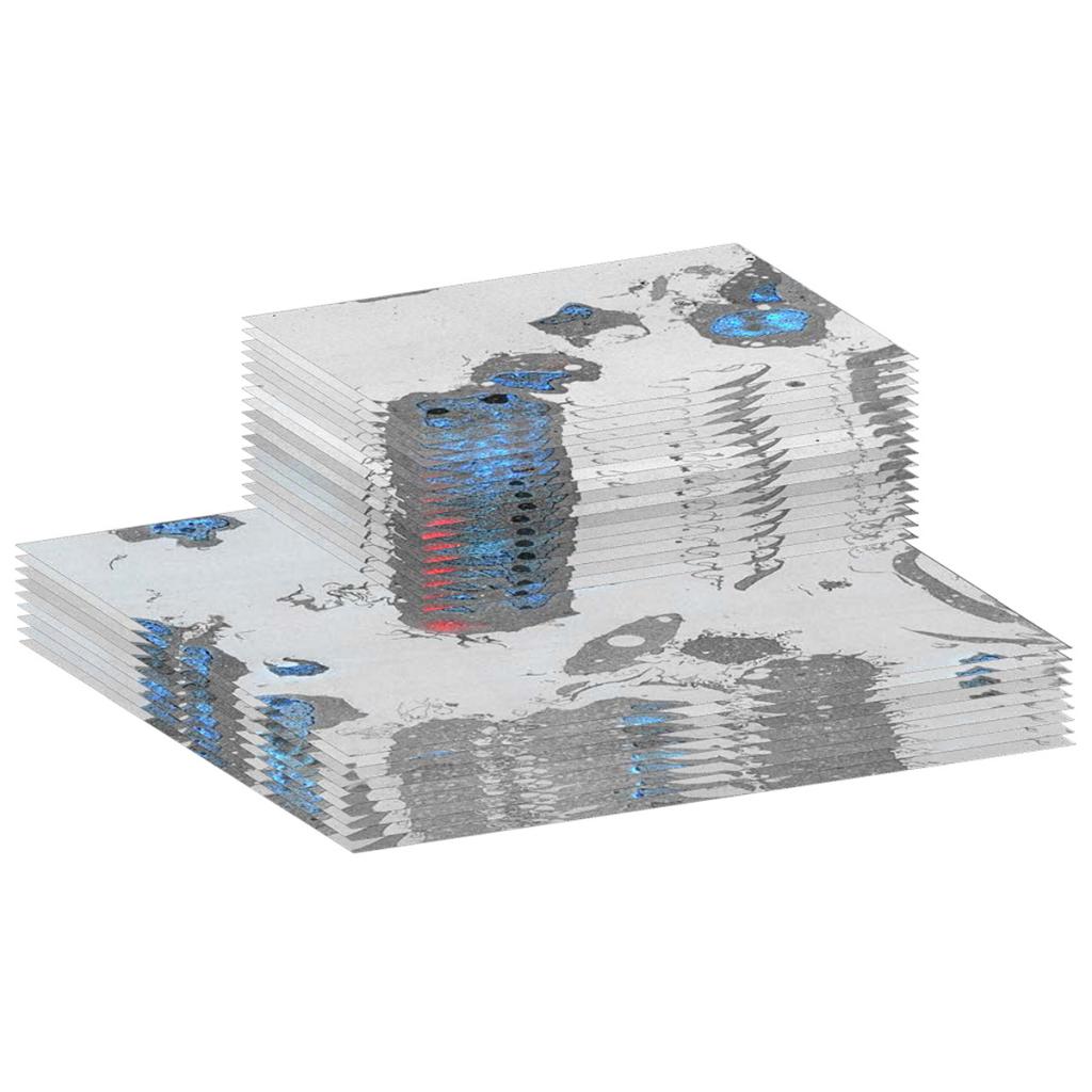 ZEISS ZEN Correlative Array Tomography