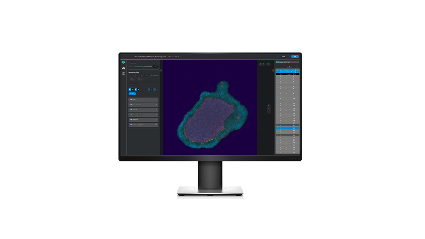 ZEISS arivis Cloud – Enhanced Image Analysis Solution