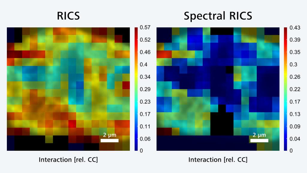ZEISS Spectral RICS