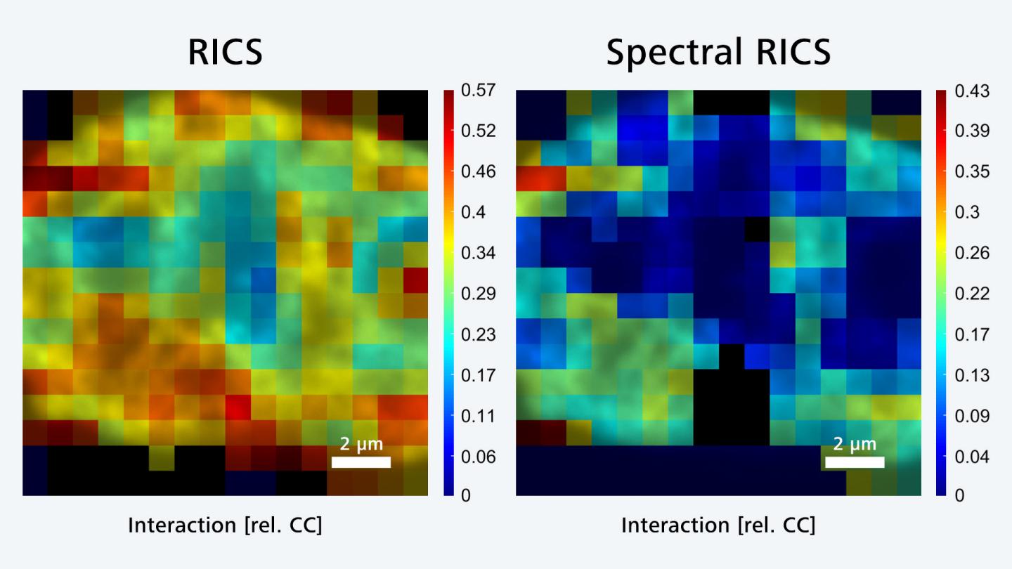ZEISS Spectral RICS