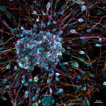 Deconvolution Toolkit | ZEISS