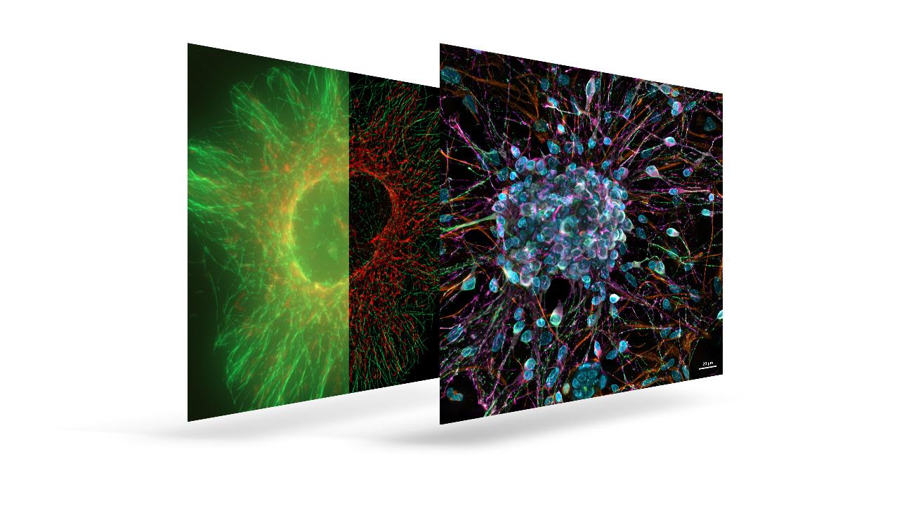 Deconvolution Toolkit | ZEISS