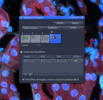 Smart Acquisition Toolkit | ZEISS
