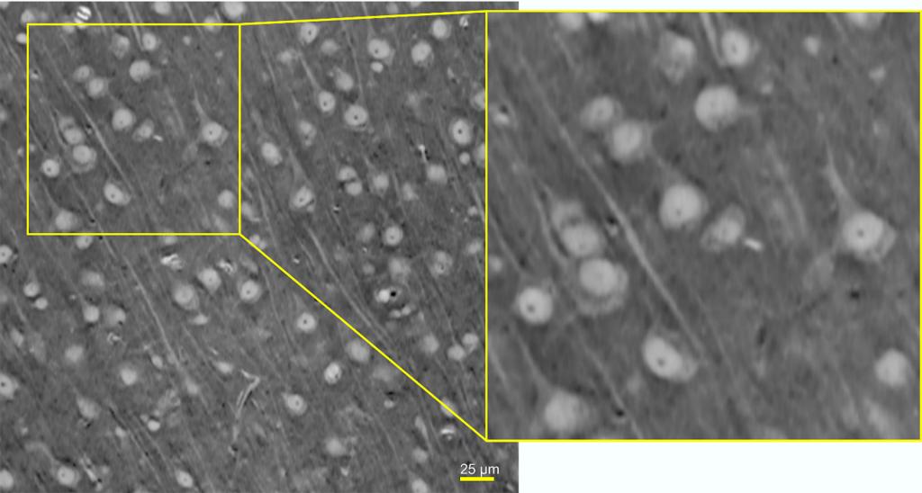 ZEISS Versa Advanced 3D X-ray Microscopes (XRM)