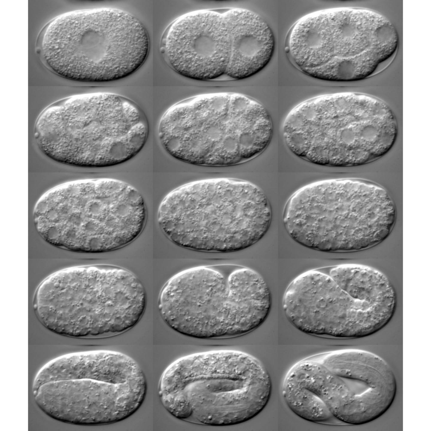 From Image to Results | AI-Powered Cell Division Tracking in C. elegans ...