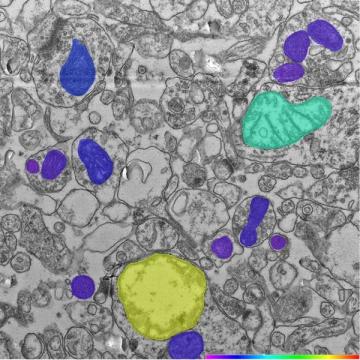 Mitochondria Image Segmentation and Classification | ZEISS