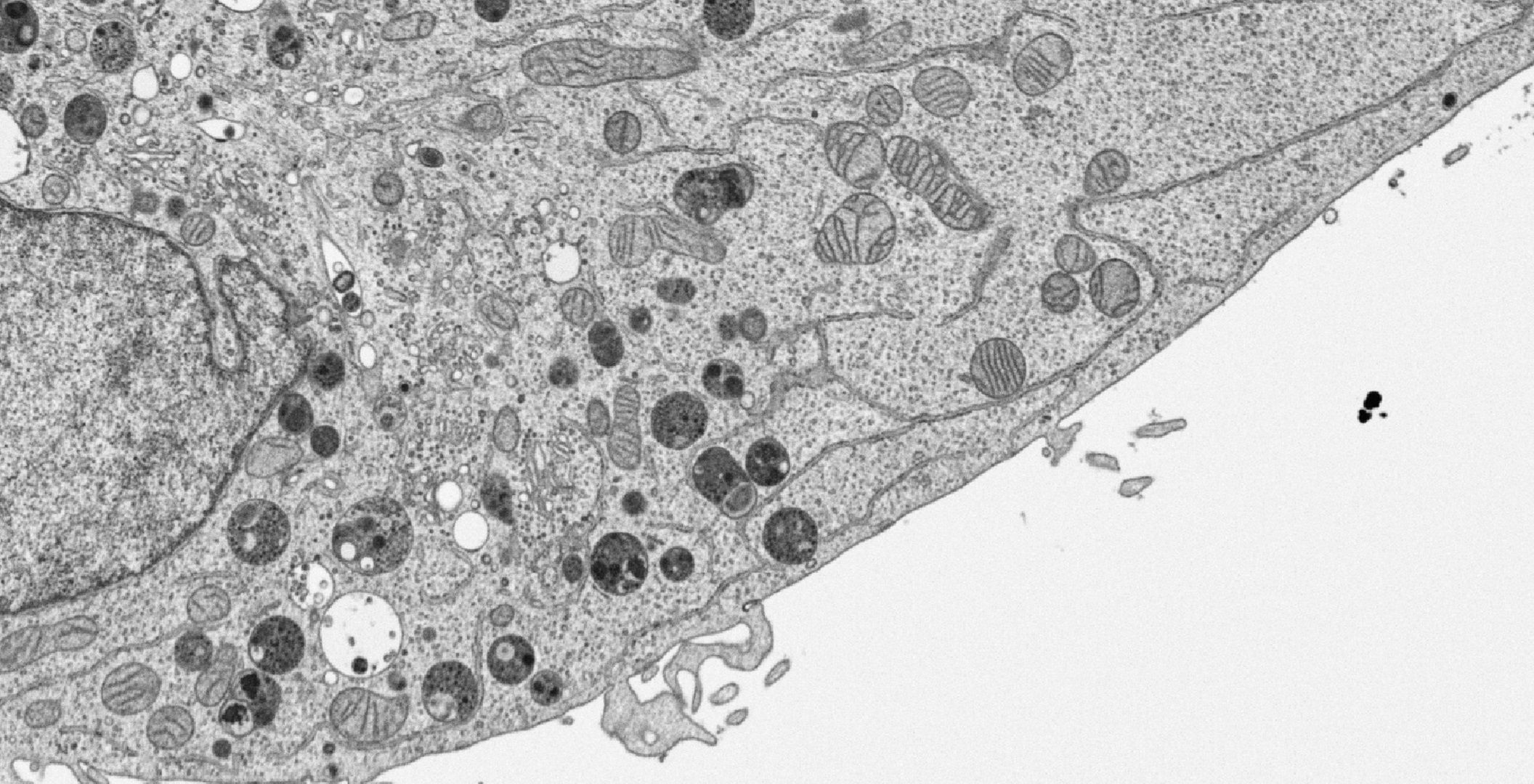 Mitochondria Image Segmentation And Classification Zeiss