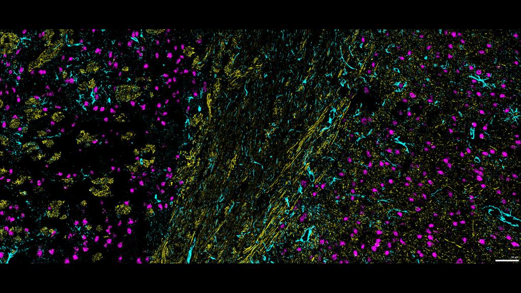 From Image to Results | Enabling 3D Multiplexing Spatial Omics ...