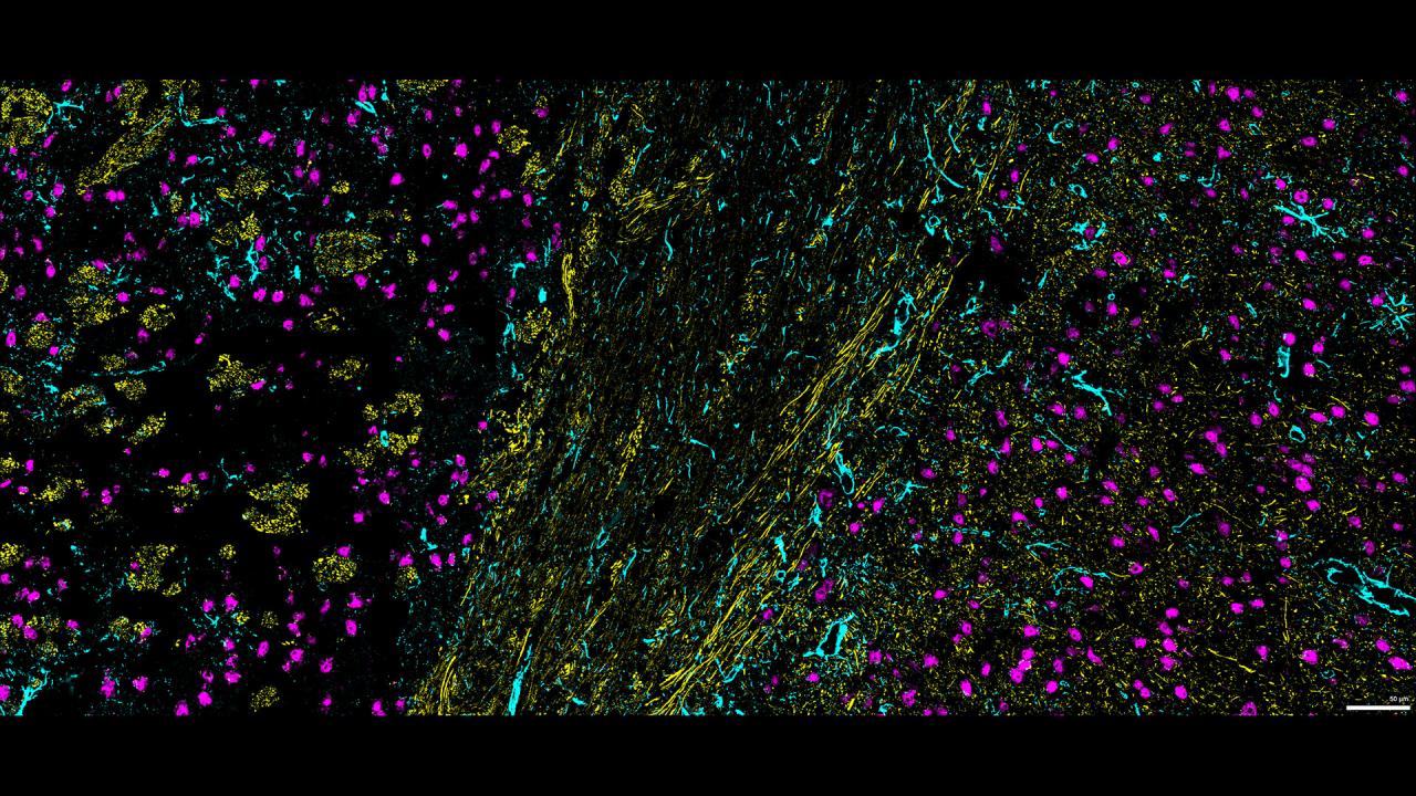 From Image to Results | Enabling 3D Multiplexing Spatial Omics Workflows in Neuroscience
