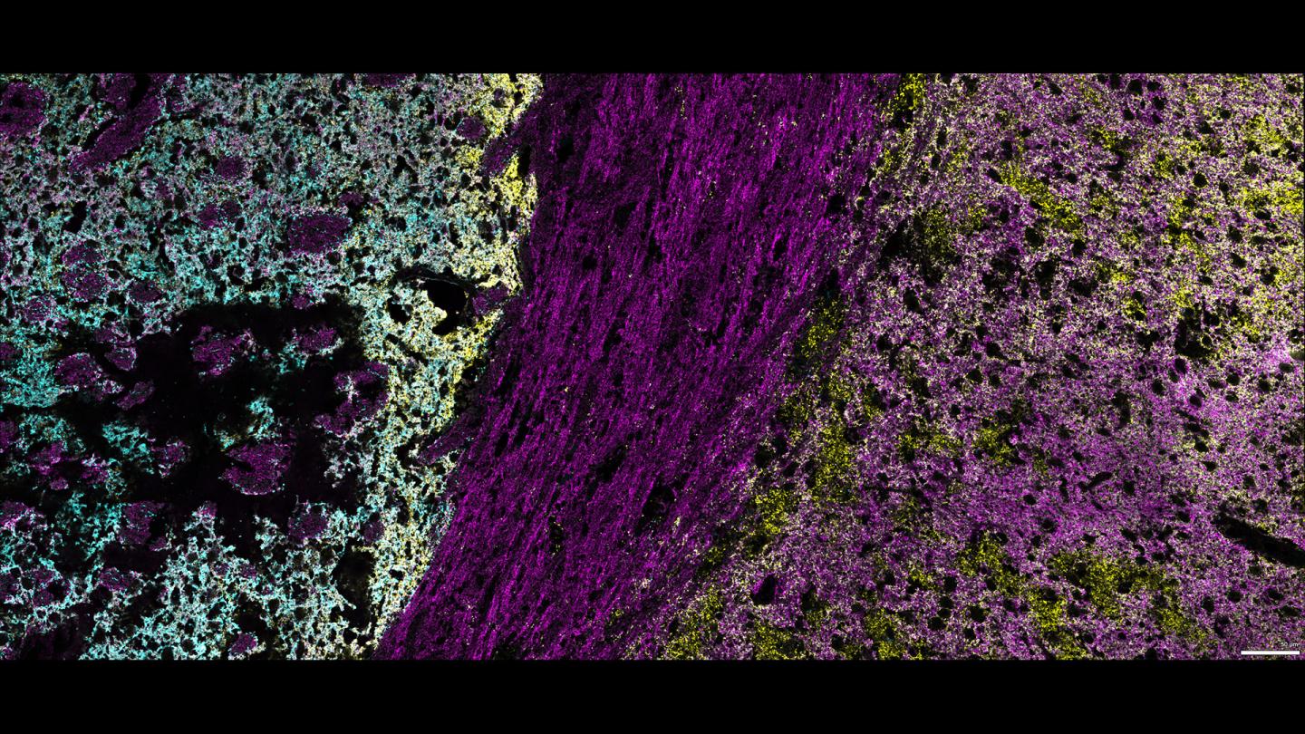 From Image to Results | Enabling 3D Multiplexing Spatial Omics ...