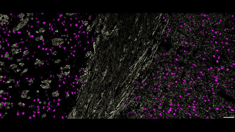 From Image to Results | Enabling 3D Multiplexing Spatial Omics ...