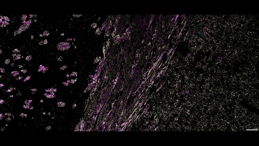 From Image to Results | Enabling 3D Multiplexing Spatial Omics ...