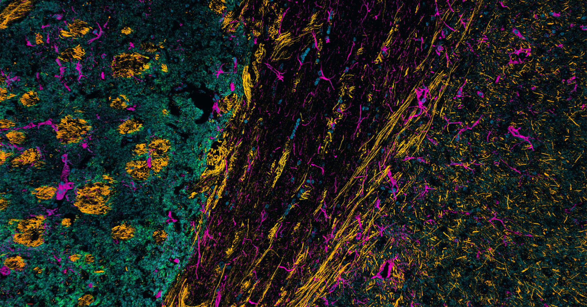 From Image to Results | Enabling 3D Multiplexing Spatial Omics ...