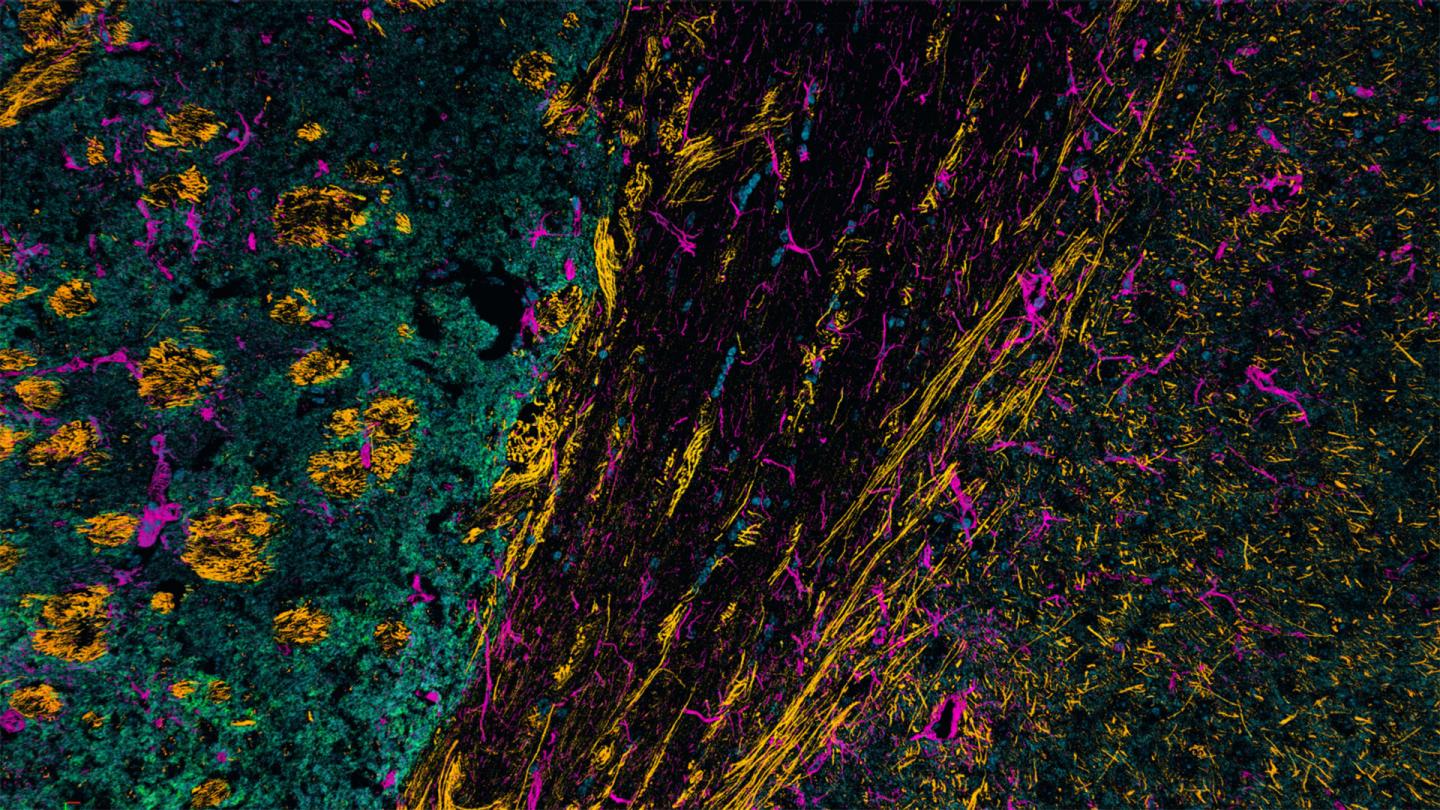 From Image To Results Enabling 3d Multiplexing Spatial Omics