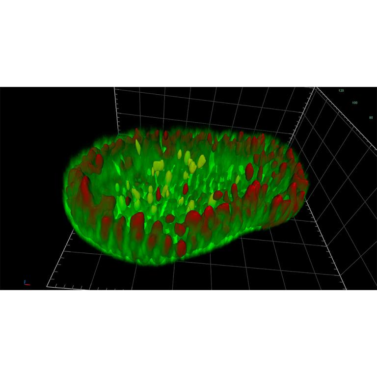 From Image to Results | Organoid Analysis | ZEISS