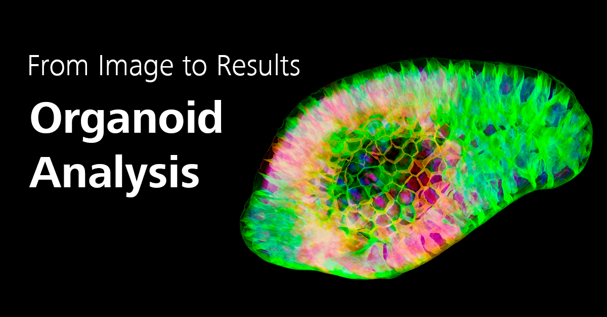 From Image to Results | Organoid Analysis | ZEISS