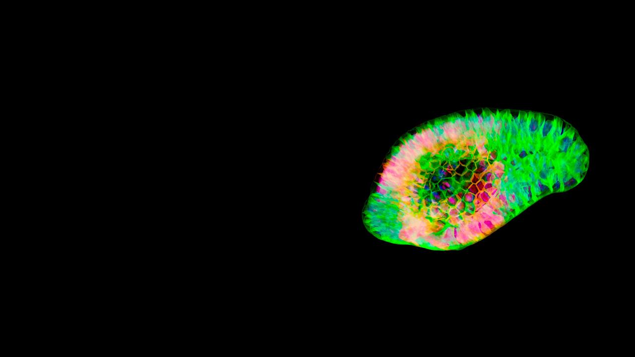 From Image to Results | Organoid Analysis | ZEISS