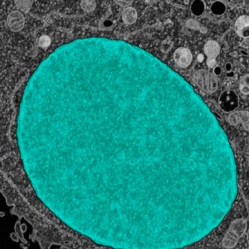 AI Image Analysis for Volume Electron Microscopy | ZEISS