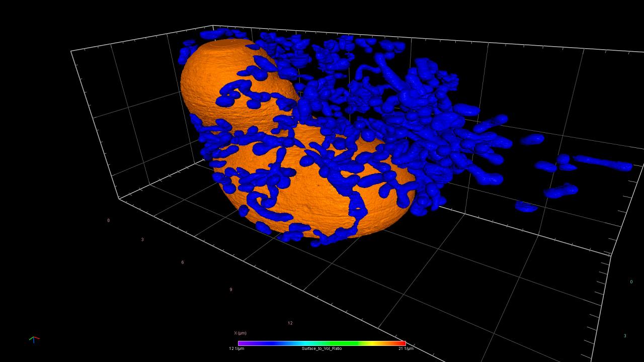 AI Image Analysis for Volume Electron Microscopy | ZEISS