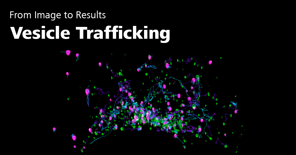 From Image to Results | Vesicle Trafficking | ZEISS