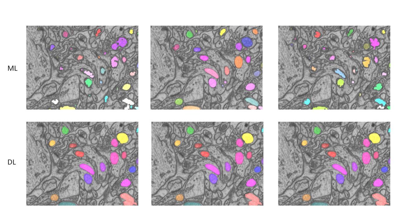 AI in Microscopy: Deep Learning for Image Analysis | ZEISS