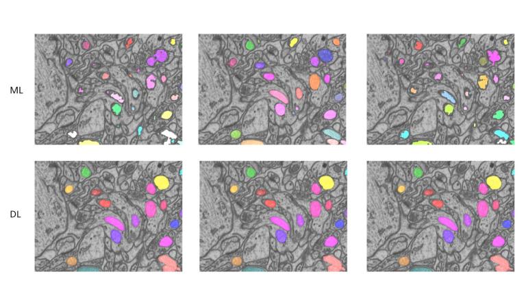 AI in Microscopy: Deep Learning for Image Analysis | ZEISS