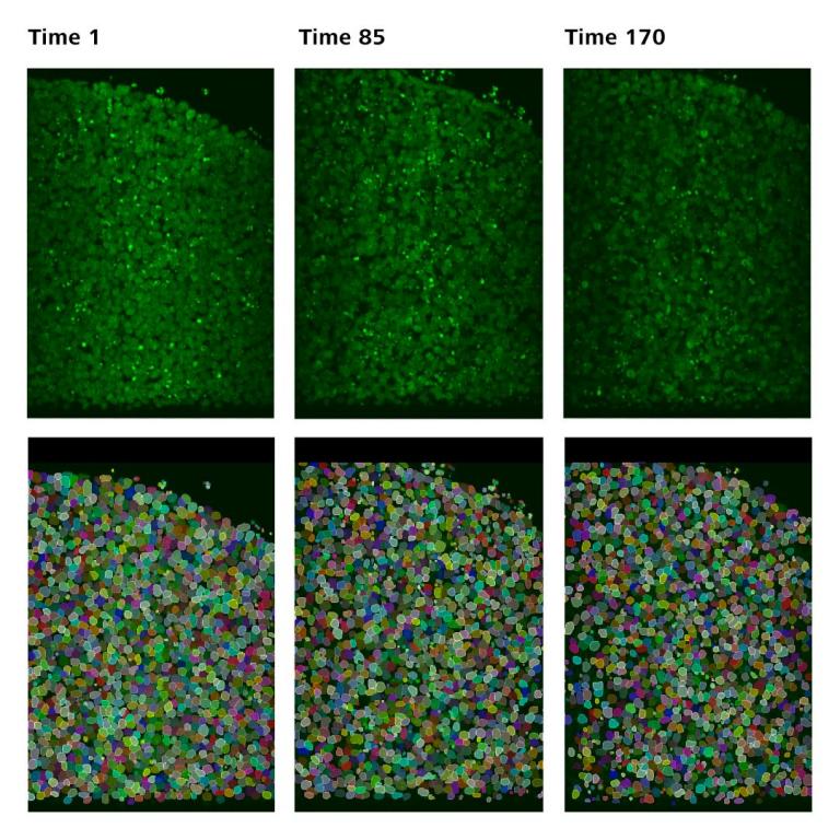 AI in Microscopy: Deep Learning for Image Analysis | ZEISS