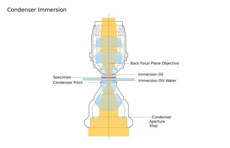 The Condenser – Its Use, Types and Applications | ZEISS