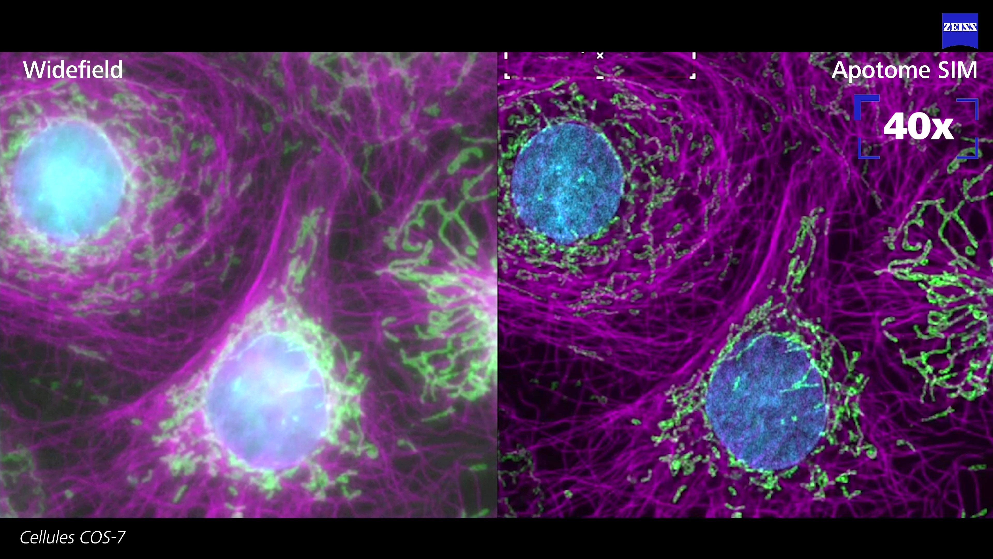 ZEISS Lattice SIM : la microscopie super-résolution à tous les ...