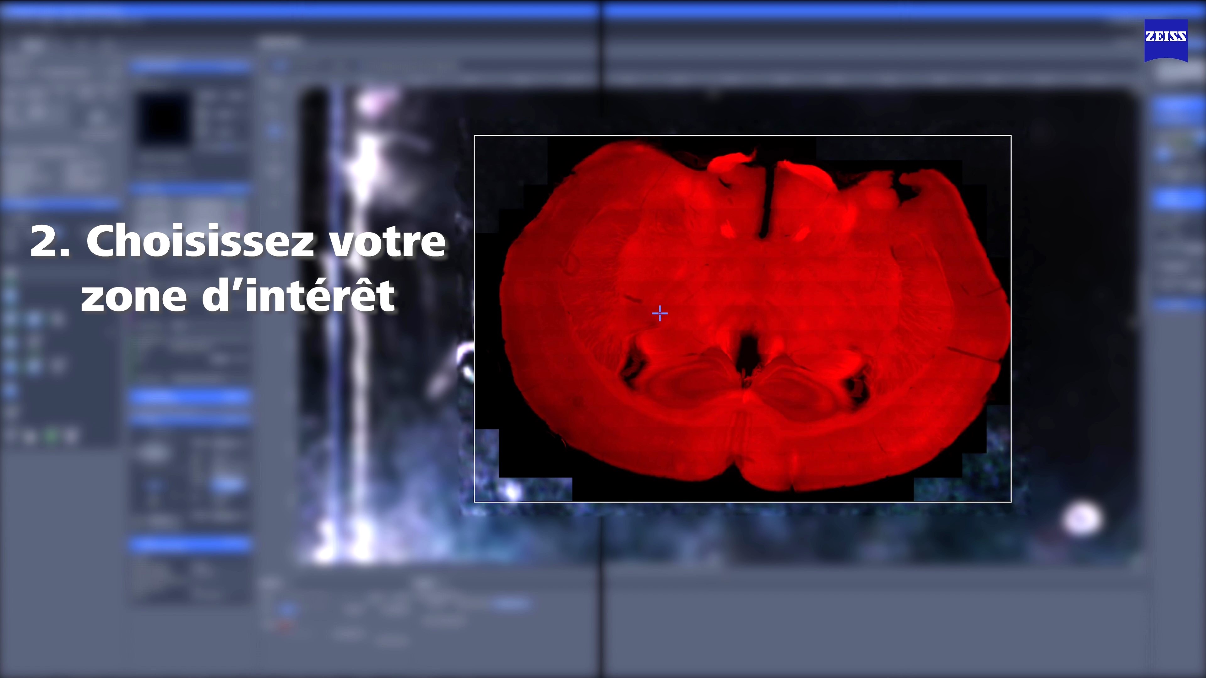 Microscopie super-résolution ZEISS Lattice SIM : votre acquisition en ...