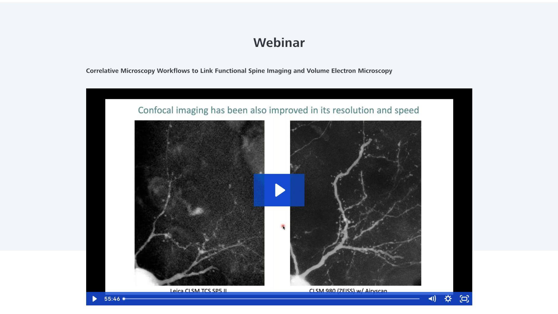 Correlative Microscopy to Link Functional Spine Imaging and Volume EM ...