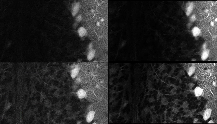 Utilizing Airyscan 2 and Miniscopes for In Vivo Imaging | ZEISS