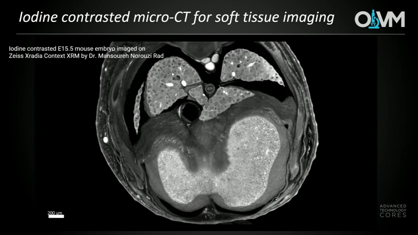 Iodine-Contrast Microct Imaging for Mouse Embryo Development from Early ...