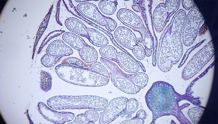 How to Set Up Koehler Illumination on Your Upright Light Microscope | ZEISS