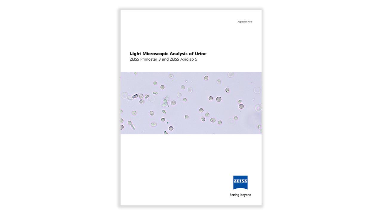 Light Microscopic Analysis of Urine | Application Note
