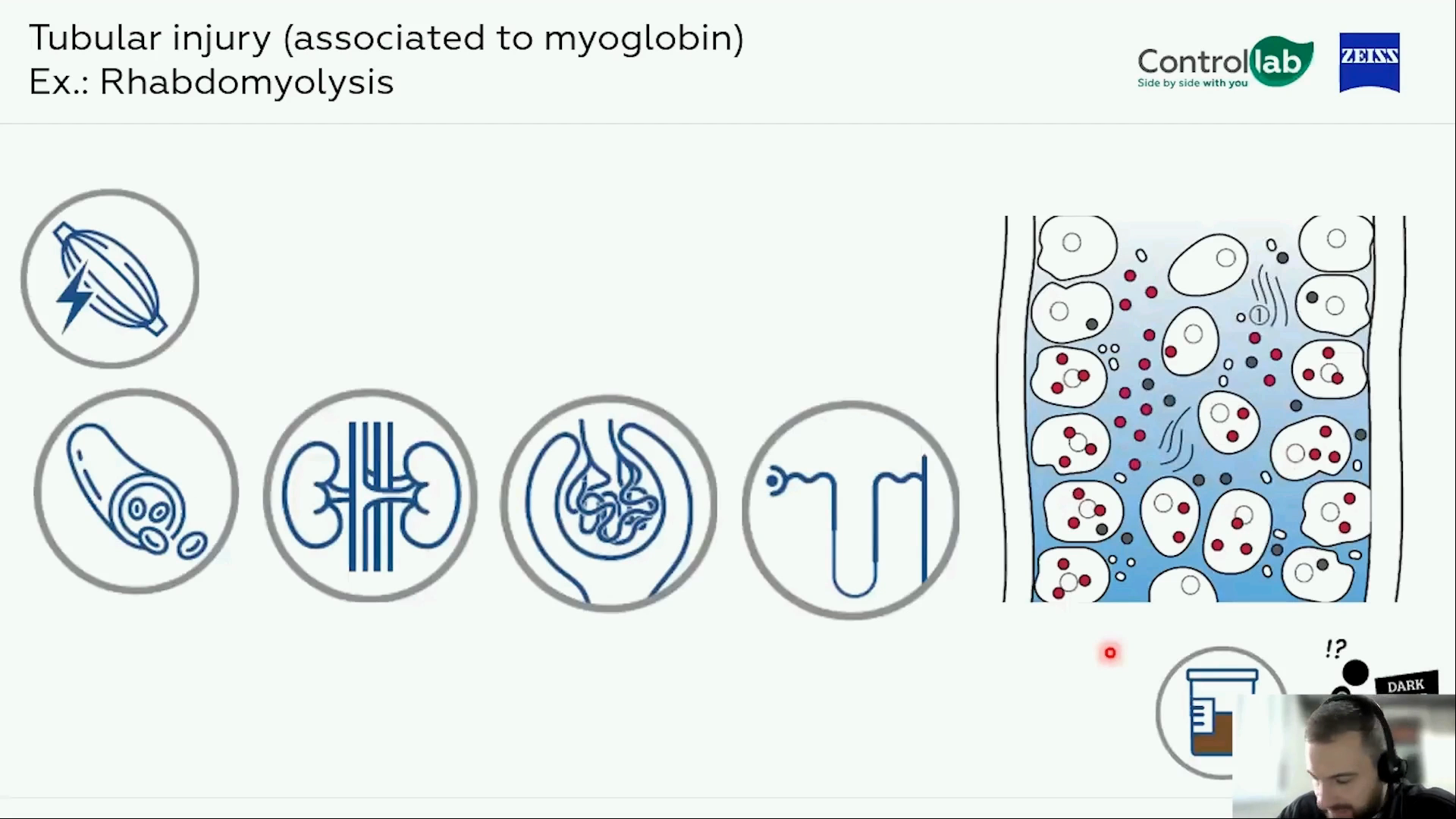 Microscopy in Urinalysis: Observe Urine, Detect Abnormalities | ZEISS