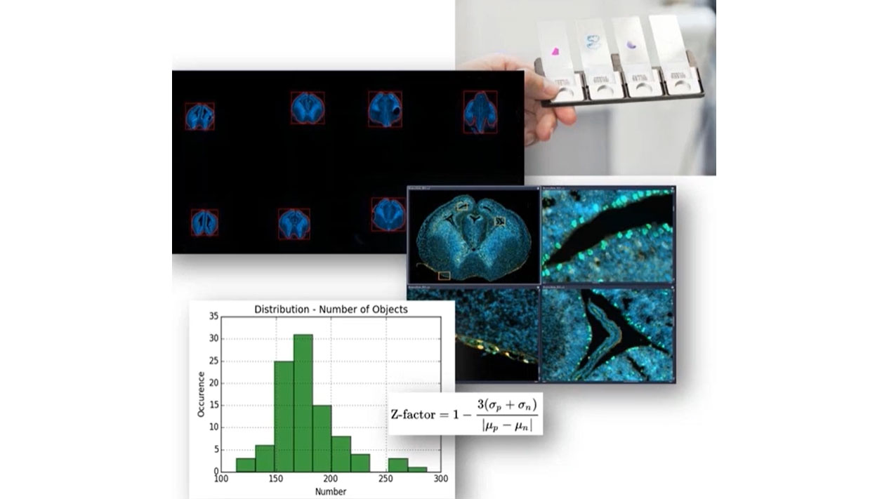 Introducing ZEISS Axioscan 7 – Multiplex Imaging Solution