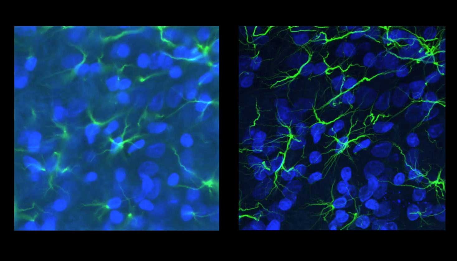 Introduction to Confocal Microscopy | ZEISS