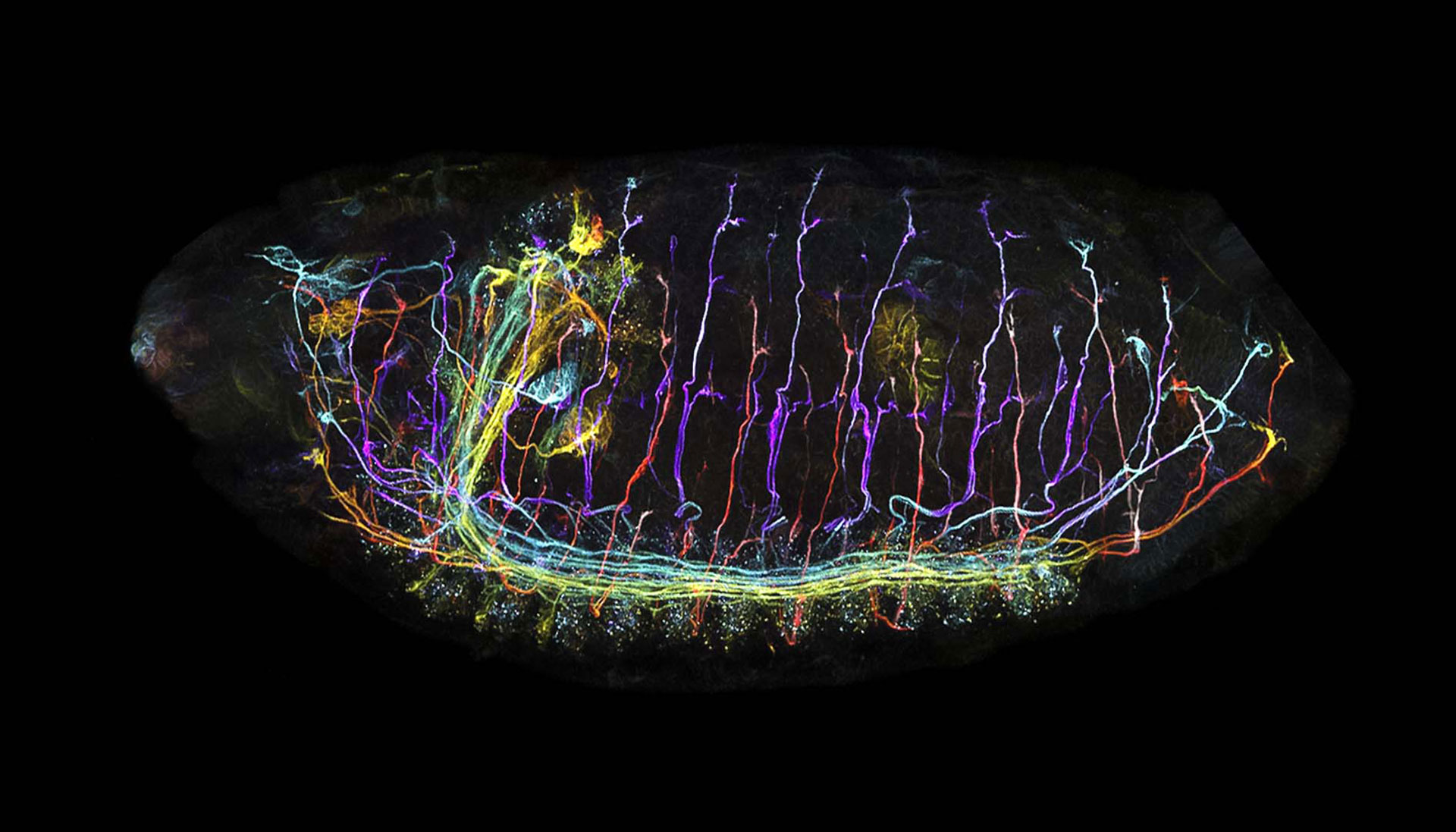Sample Preparation for Fluorescence Microscopes | ZEISS